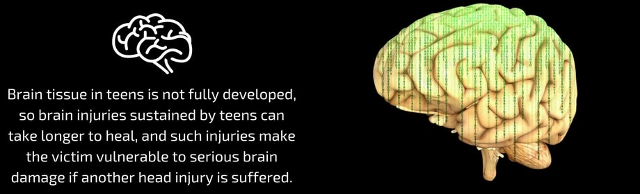 Brain Injury in Youth Sports